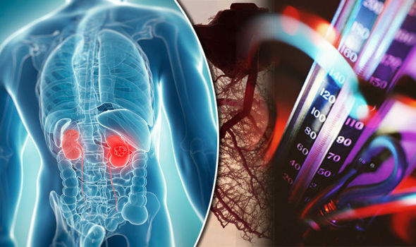 What Is The Connection Between Hypertension And Kidney Healt
